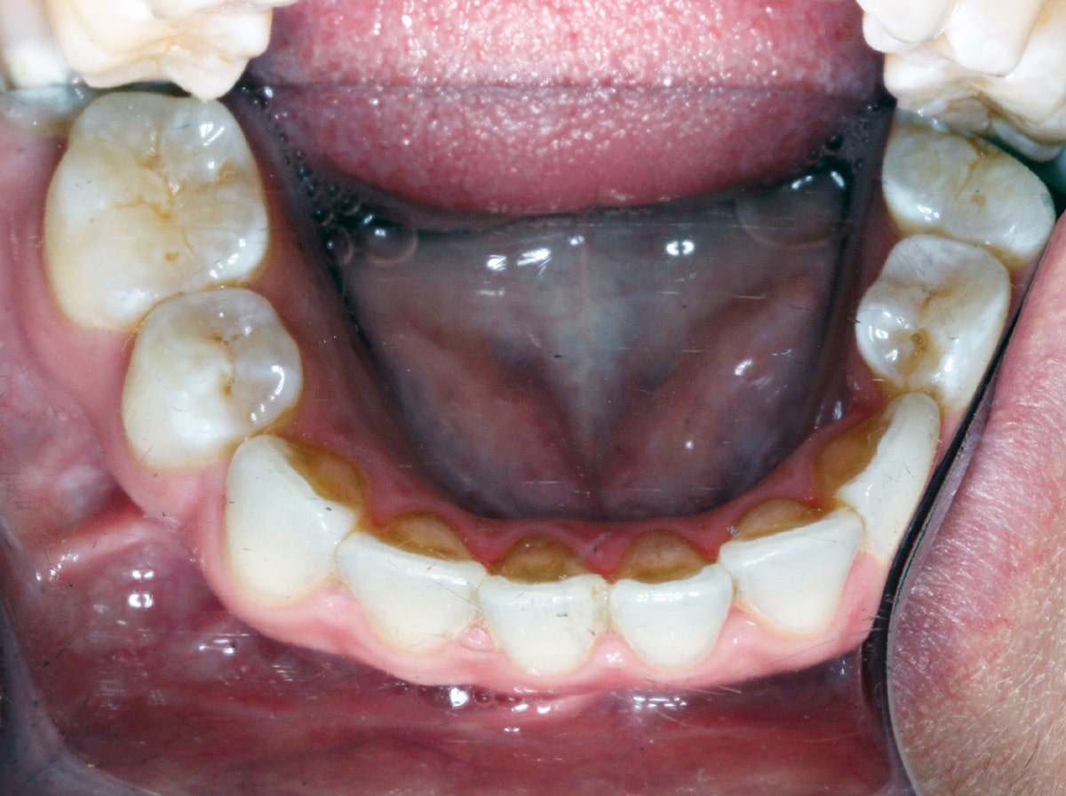 Virtual Smile Assessment - Bucks County Orthodontics